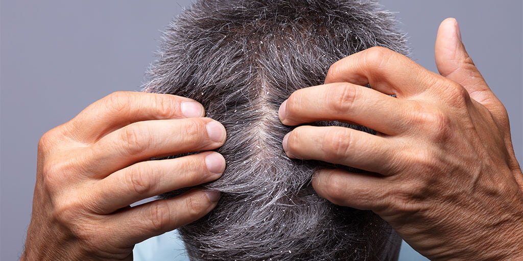 Alles wat je moet weten over roos | La Roche-Posay