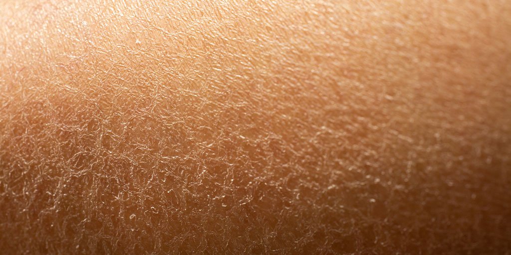 Hoe verzorg je een gedehydrateerde huid | Voor de huid die schilfert ...